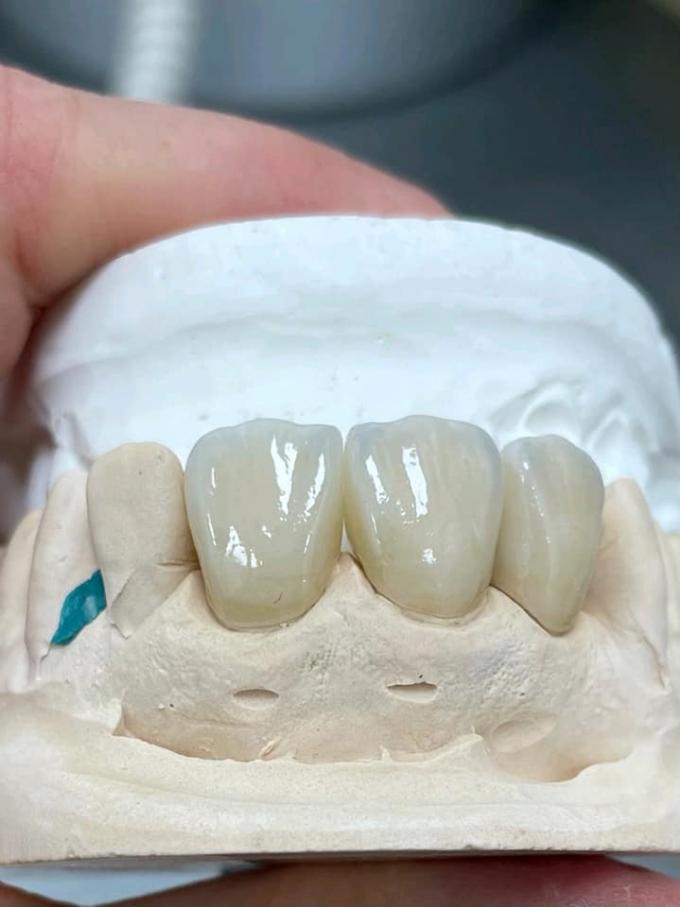 25mm 3D Pro Multilayer Zirconia Blank CAD CAM Ceramic Zirconia Block