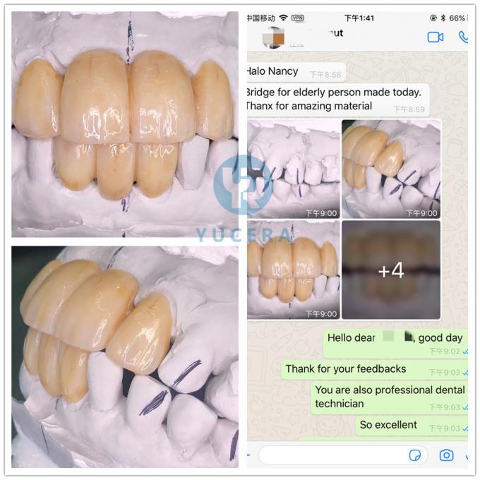 3D Pro Multilayer Dental Zirconia Discs For CAD CAM CNC Milling Machine