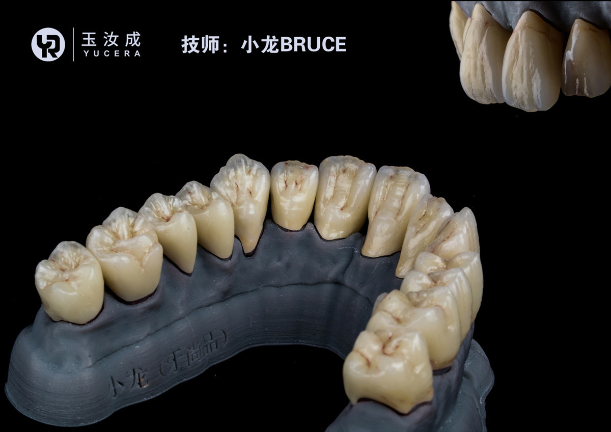 A1 A2 3D 1050MPA Dental Zirconia Block For Laboratorio Dental